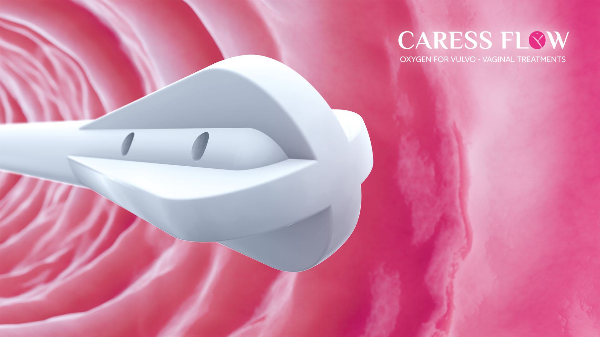 Caress flow - GIN-MEDICAL